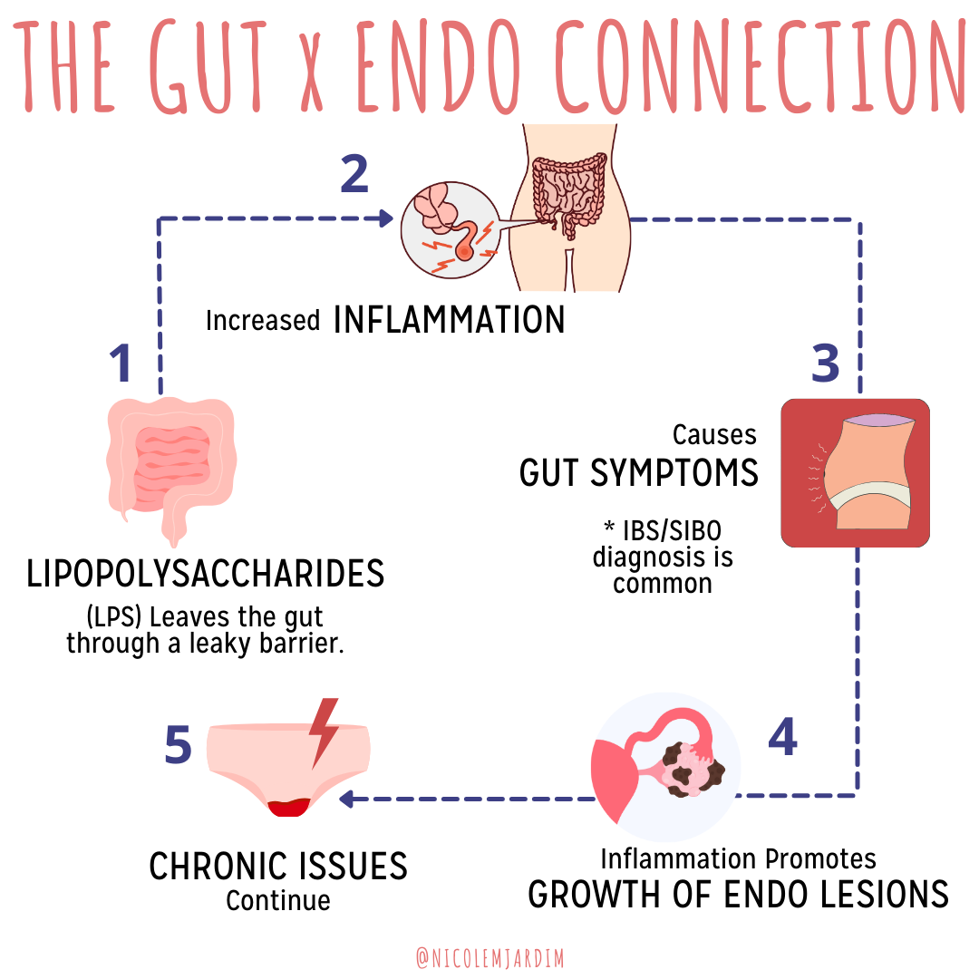 Endometriosis, Histamine and Gut Health – Nicole Jardim